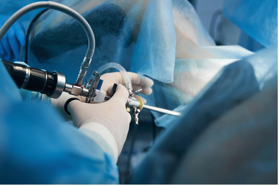 Hysteroscopic Adhesiolysis: A Minimally Invasive Treatment for Asherman ...